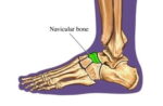 Hueso navicular (definición, función, vascularización, fracturas ...
