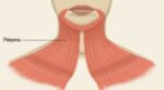 Músculo platisma o músculo cutáneo del cuello (anatomia)