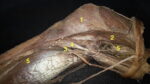 Nervio safeno anatomia, origen, inervación, ramas, importancia clínica
