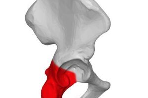 Hueso ilíaco o coxal (anatomia, función, lesiones y sus partes)