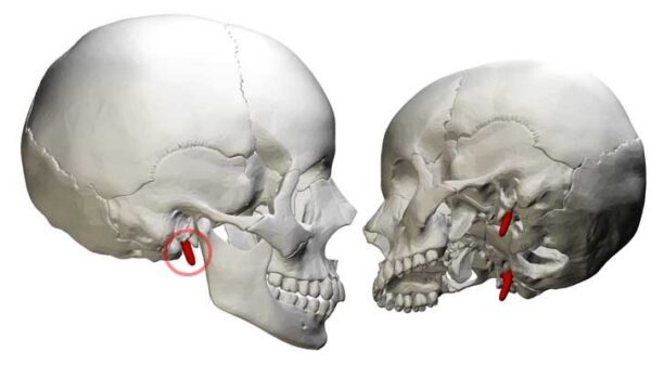 Apófisis estiloides (musculos que se insertan y ligamentos)