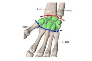 Huesos carpianos o huesos del carpo | Anatomía Topográfica