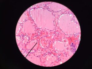 Histología de la glándula tiroides (anatomía, embriología)