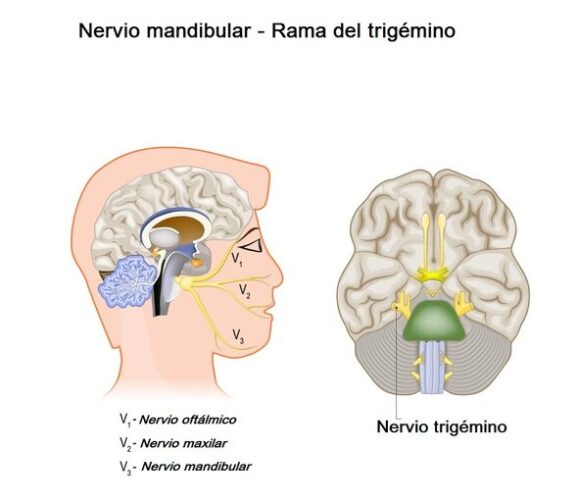 Nervio mandibular (nervio craneal V3) origen y ramas