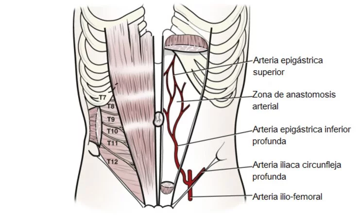 Anatomía De La Arteria Epigástrica Inferior