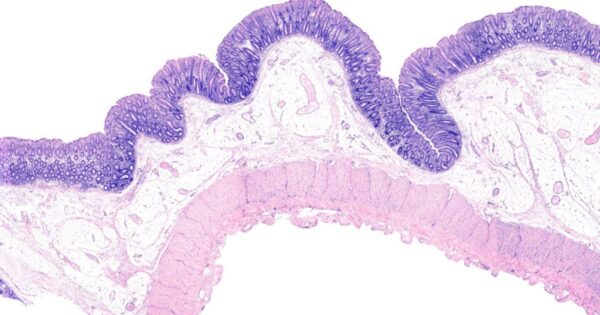 🥇 Histología del Intestino Grueso - Anatomía y Funciones