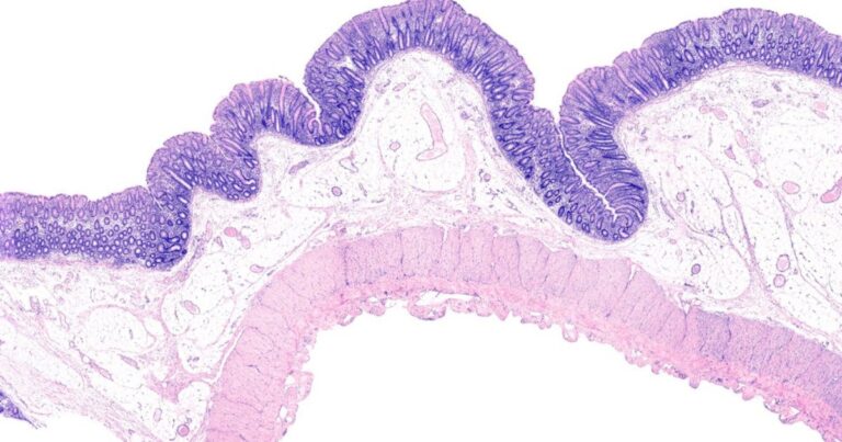 🥇 Histología del Intestino Grueso - Anatomía y Funciones